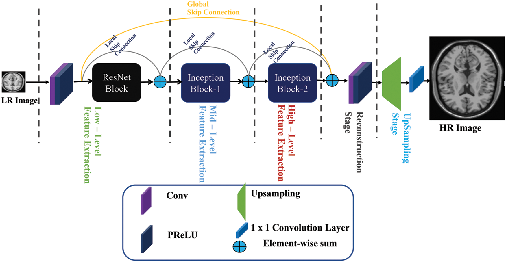 CMES | Free Full-Text | IRMIRS: Inception-ResNet-Based Network for MRI ...