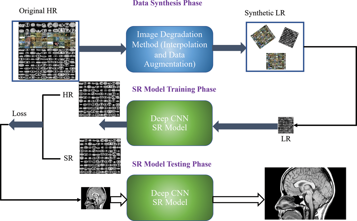 CMES | Free Full-Text | IRMIRS: Inception-ResNet-Based Network for MRI ...
