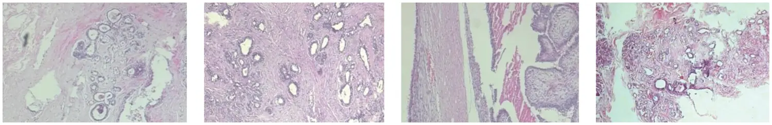 CMES | Free Full-Text | A Survey of Convolutional Neural Network in ...