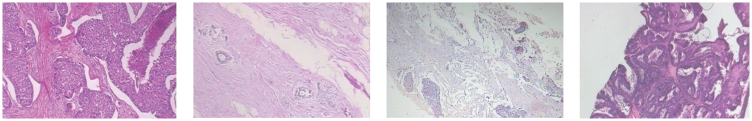 CMES | Free Full-Text | A Survey of Convolutional Neural Network in ...