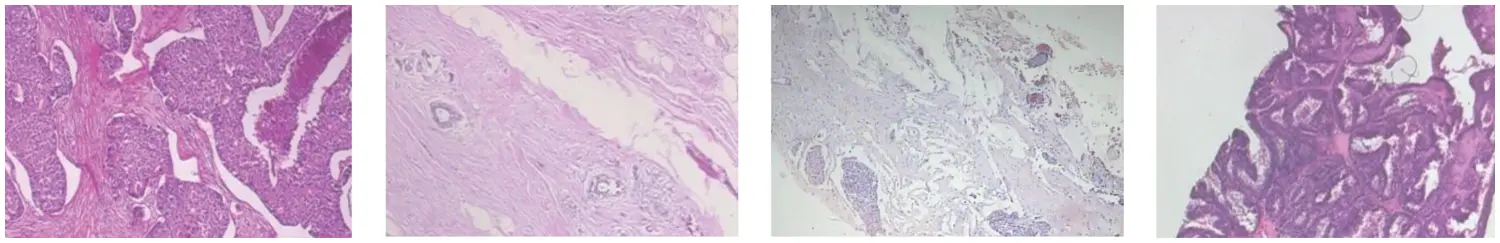 CMES | Free Full-Text | A Survey of Convolutional Neural Network in ...