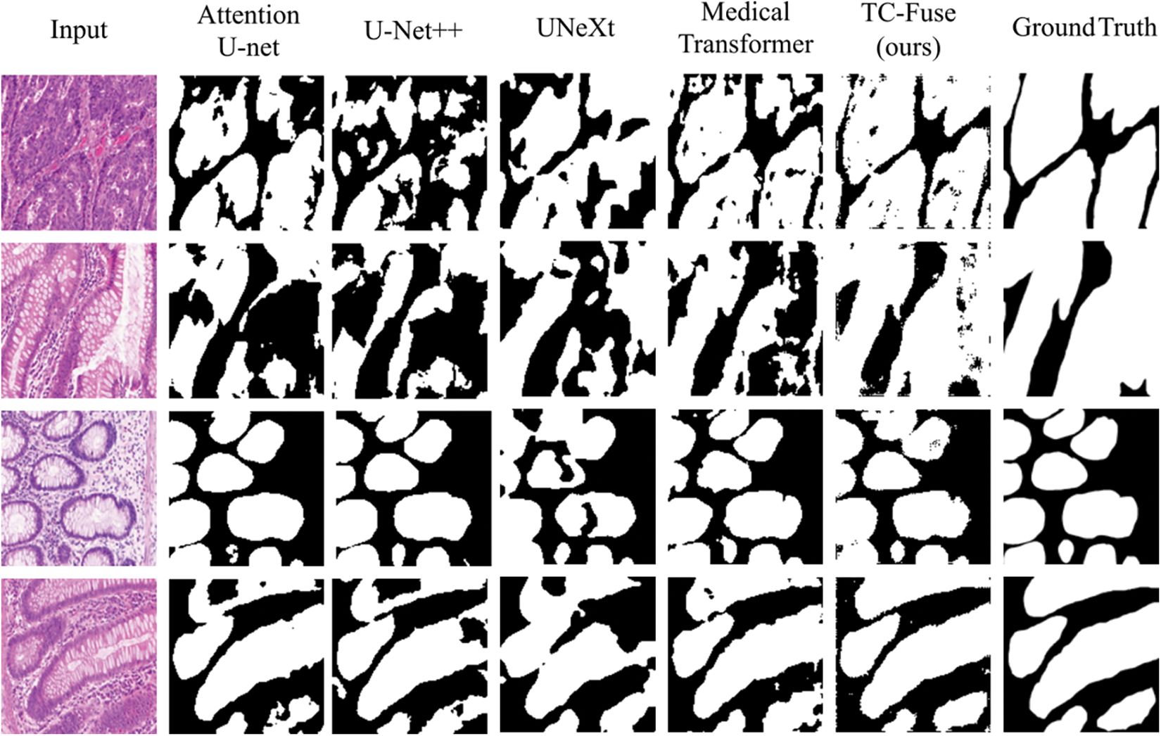 CMES | Free Full-Text | TC-Fuse: A Transformers Fusing CNNs Network for ...