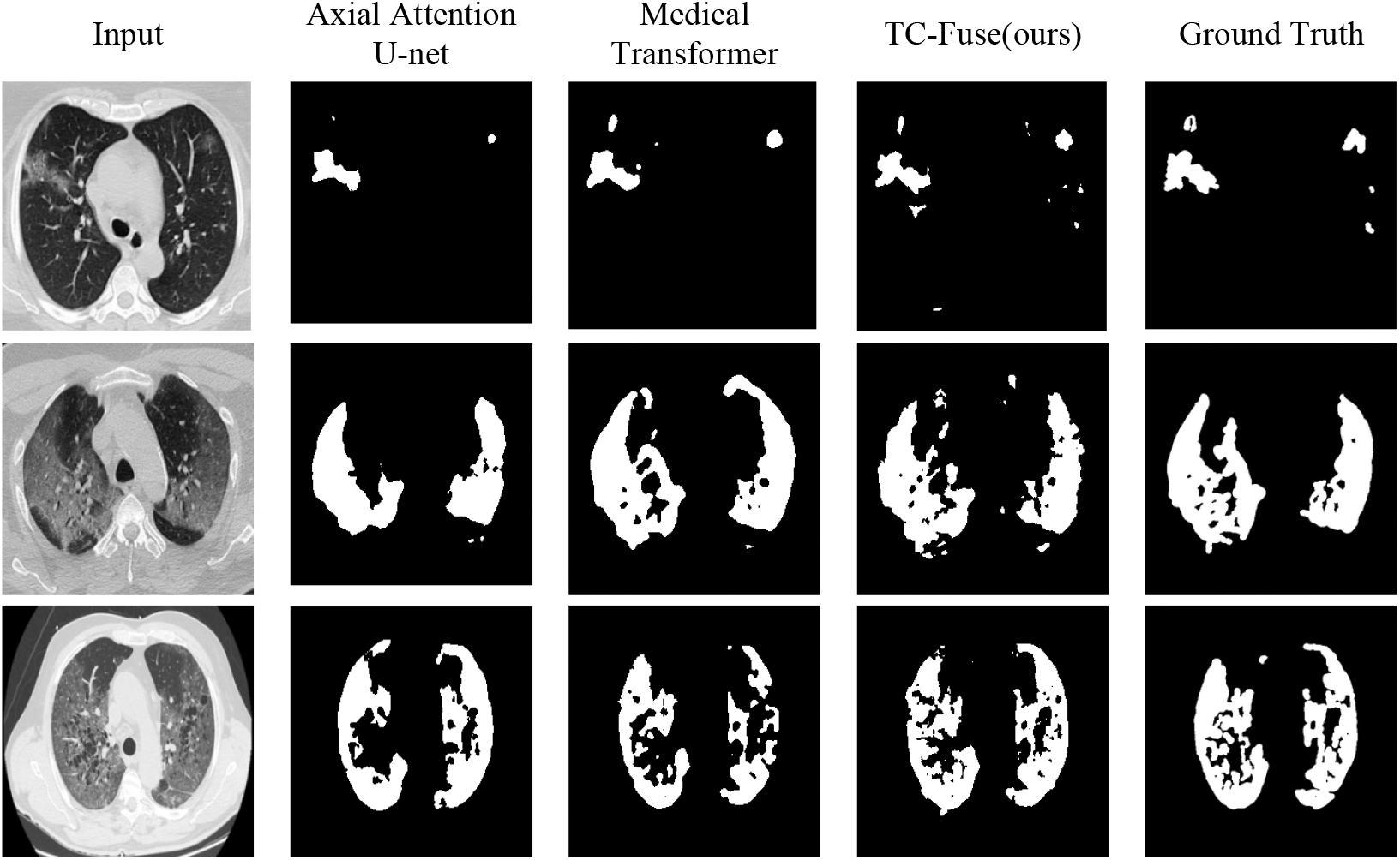 CMES | Free Full-Text | TC-Fuse: A Transformers Fusing CNNs Network for Medical Image Segmentation