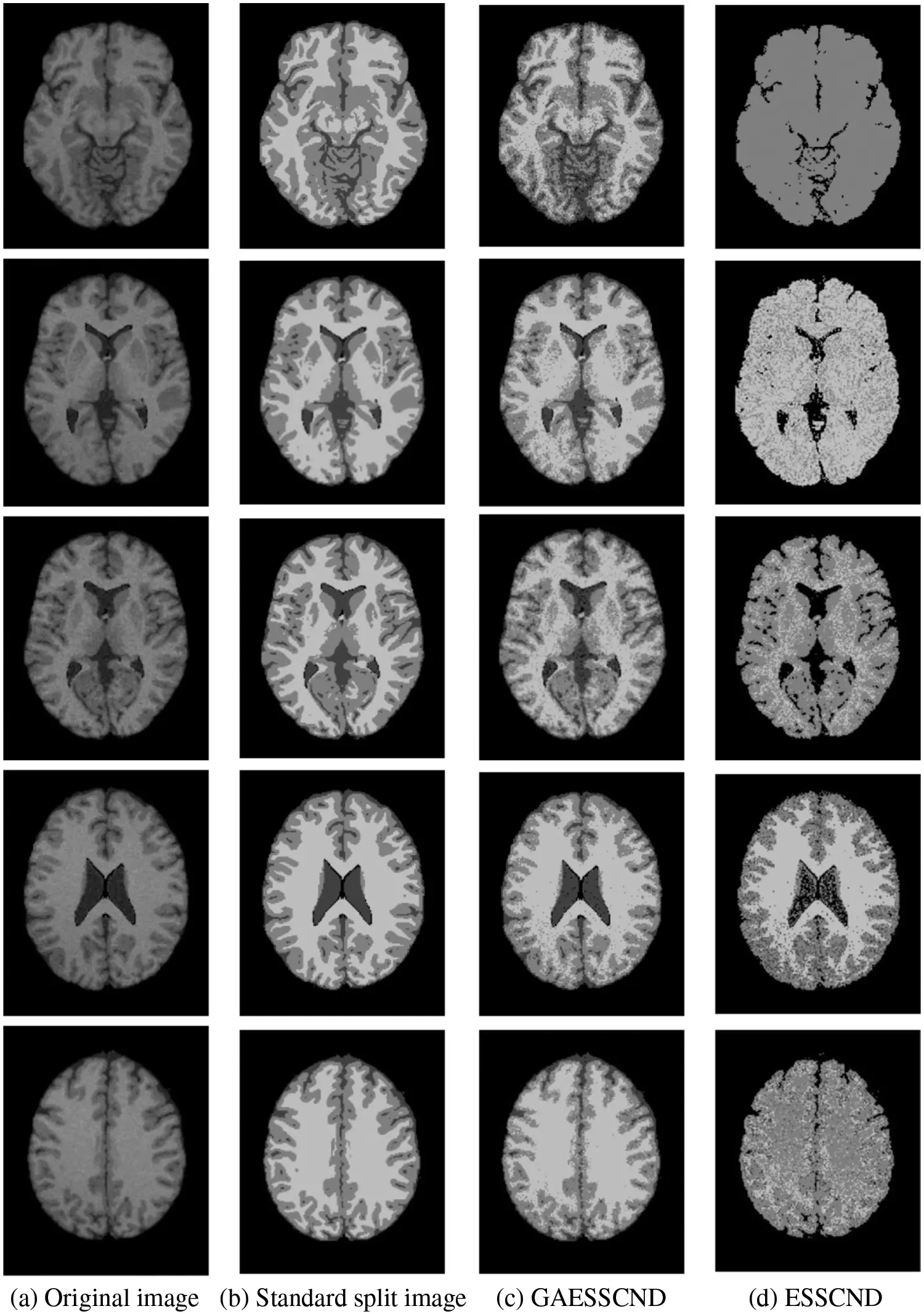 CMES | Free Full-Text | An Improved Soft Subspace Clustering Algorithm for Brain MR Image ...