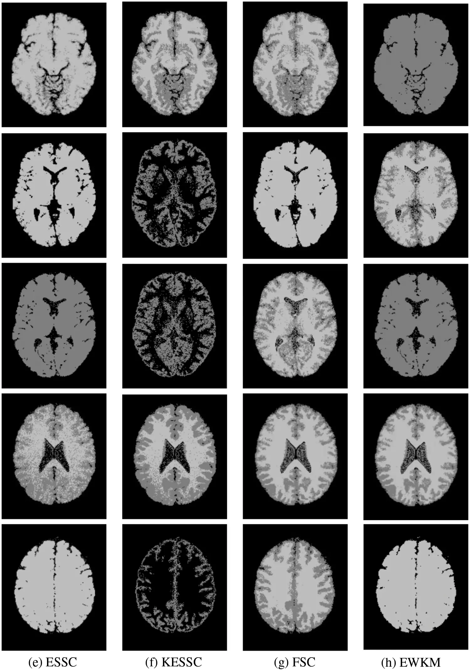CMES | Free Full-Text | An Improved Soft Subspace Clustering Algorithm for Brain MR Image ...