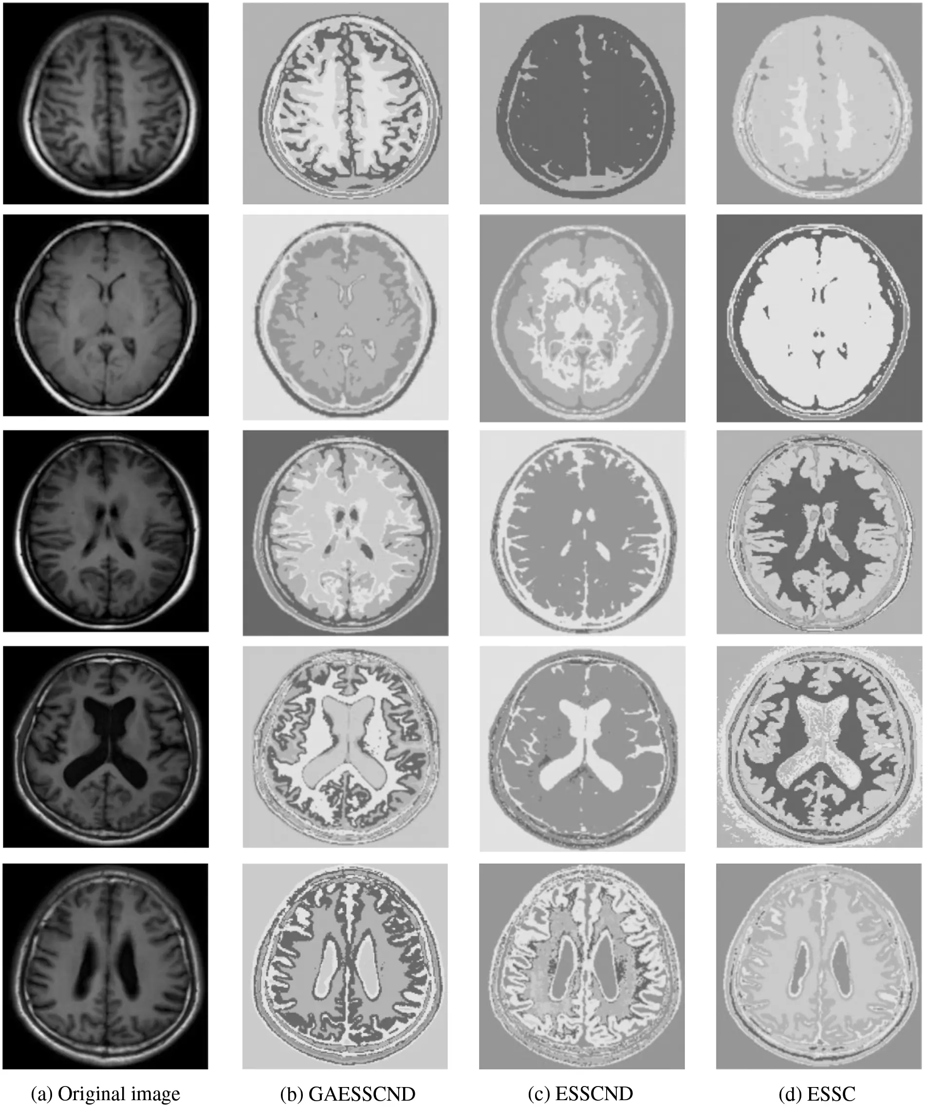 CMES | Free Full-Text | An Improved Soft Subspace Clustering Algorithm for Brain MR Image ...