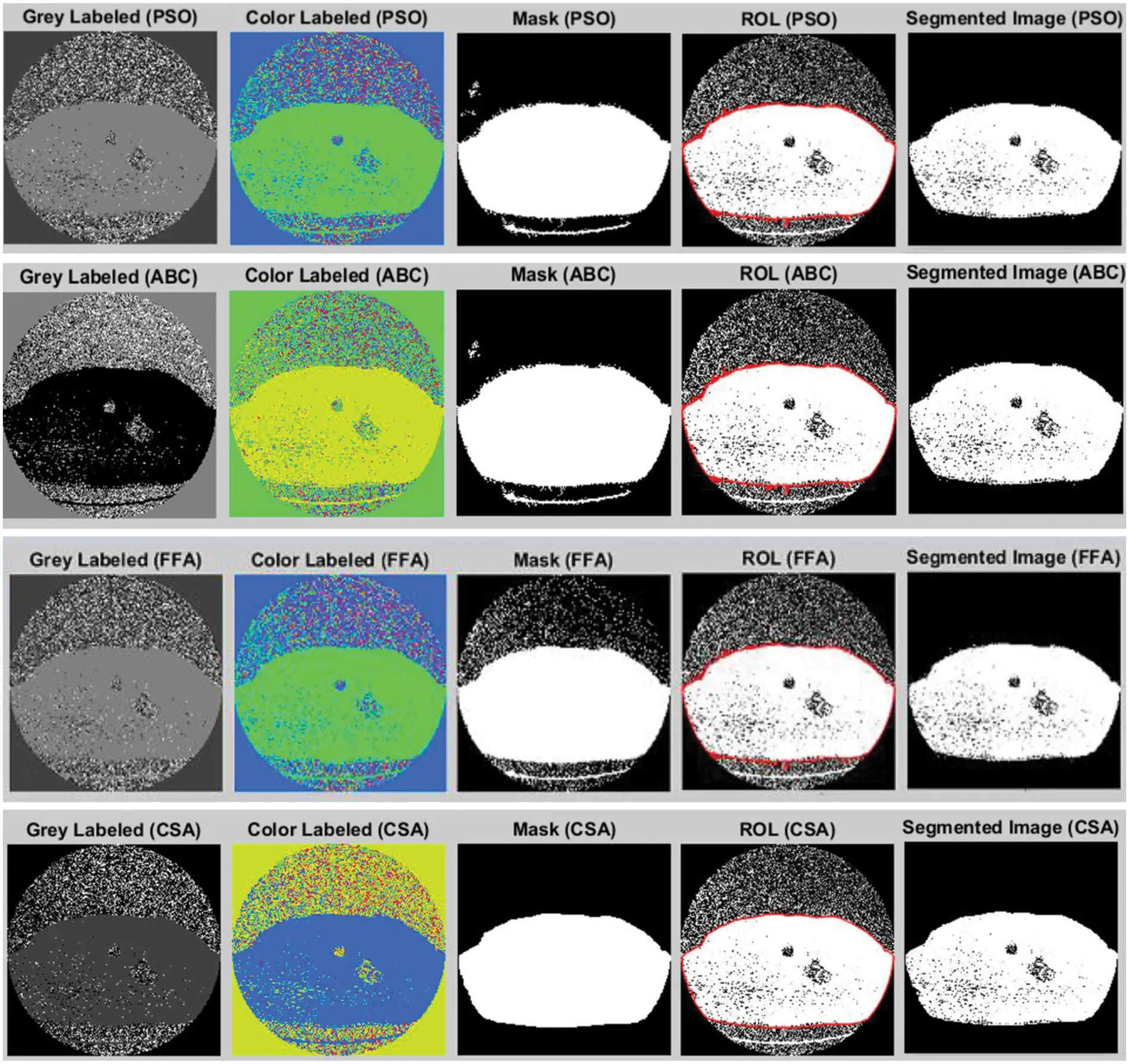 CMES | Free Full-Text | An Improved Lung Cancer Segmentation Based on Nature-Inspired ...