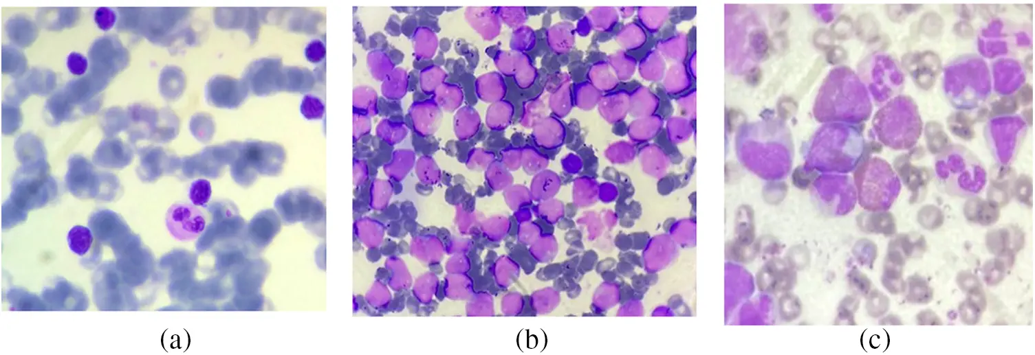 CMES | Free Full-Text | A New Method for Diagnosis of Leukemia ...