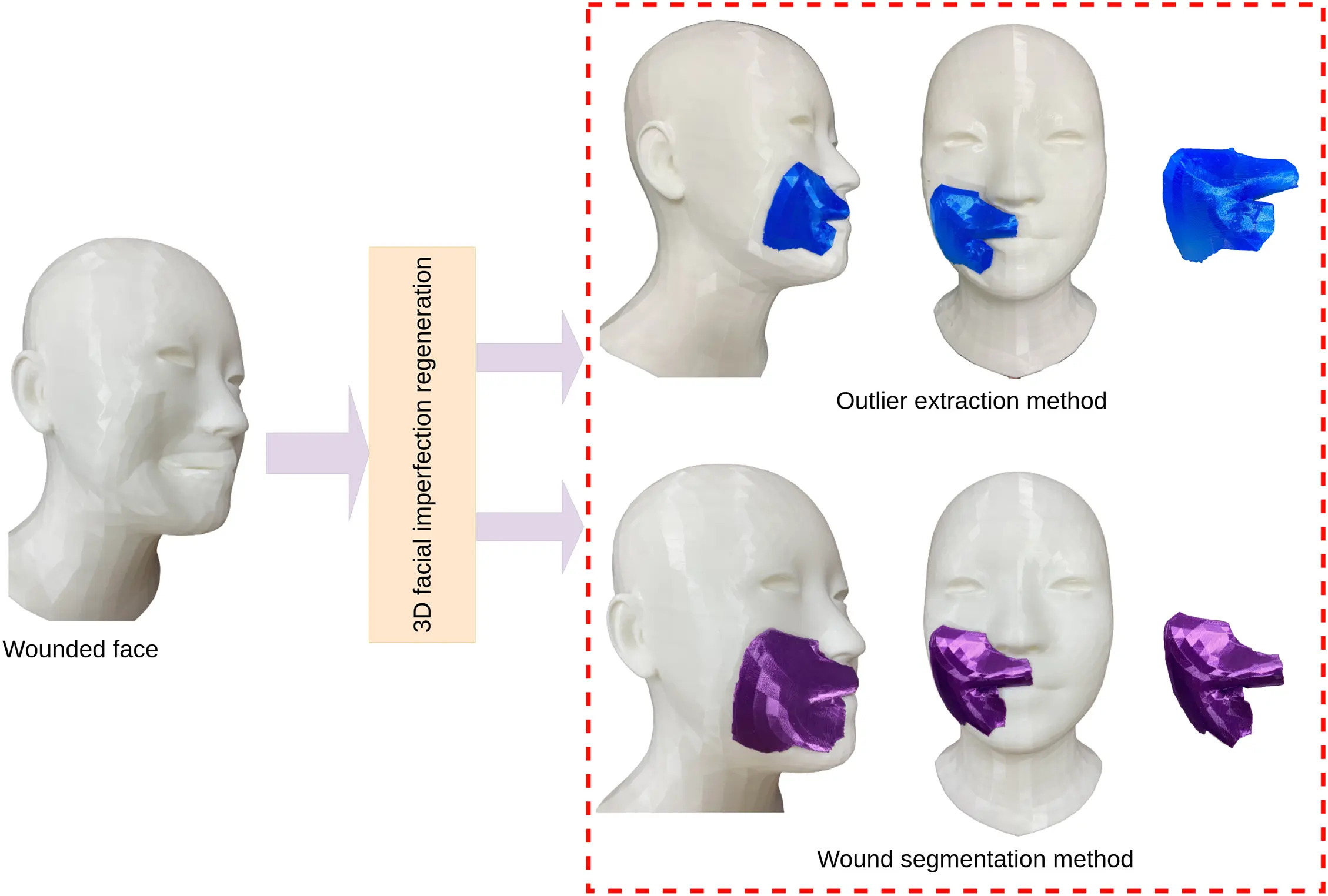 CMES | Free Full-Text | Advancing Wound Filling Extraction on 3D Faces ...