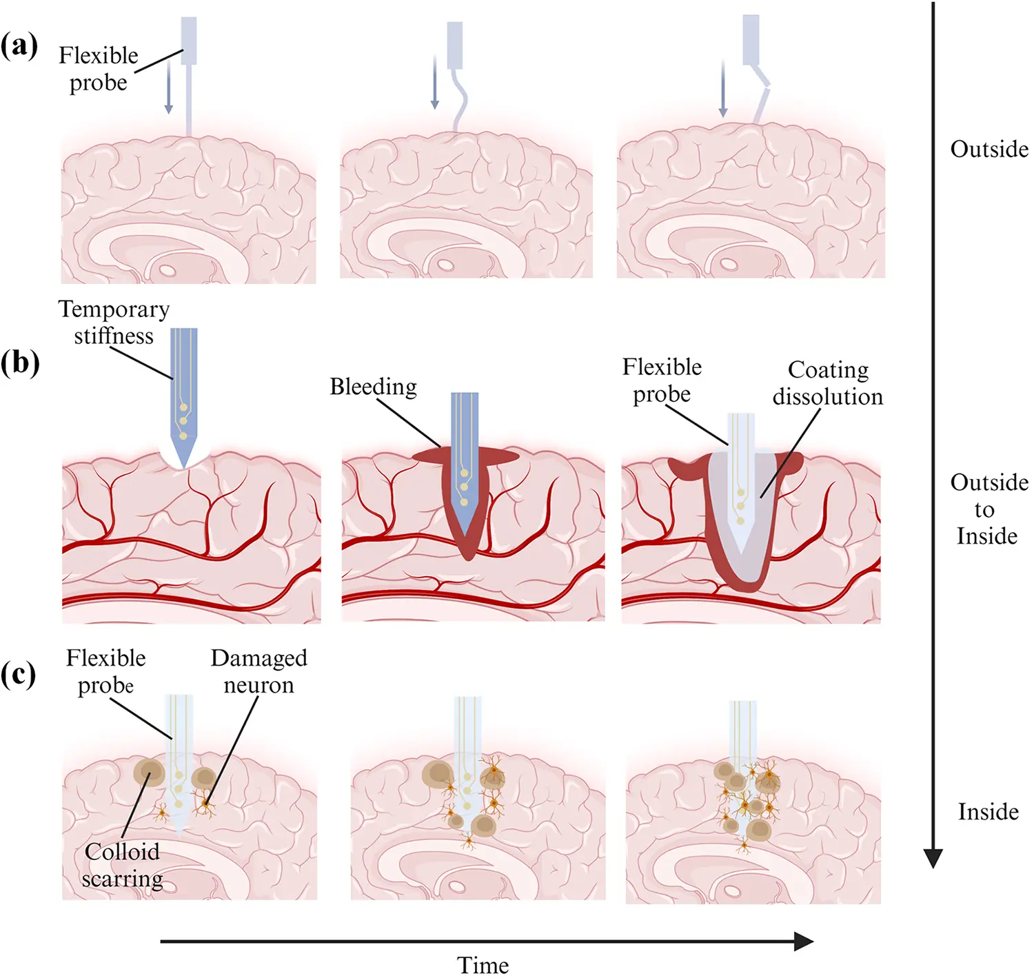 CMES | Free Full-Text | Progress in Mechanical Modeling of Implantable ...