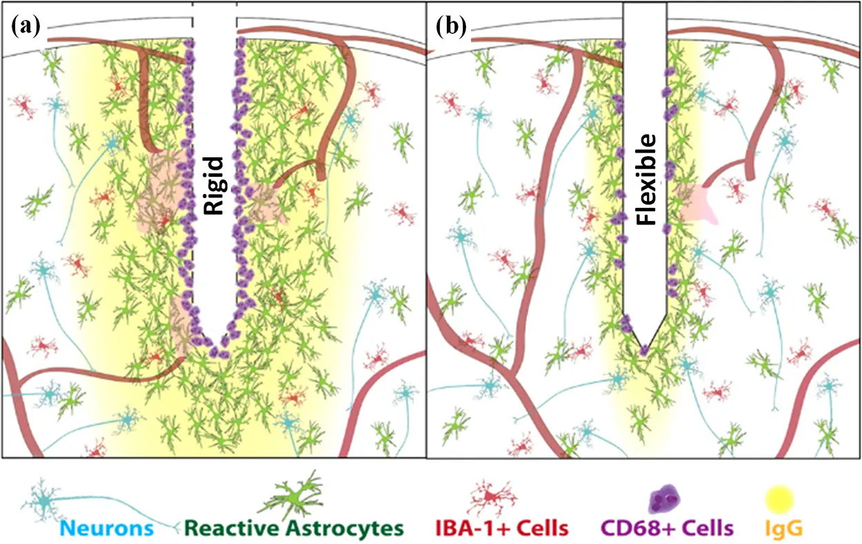 CMES | Free Full-Text | Progress in Mechanical Modeling of Implantable ...