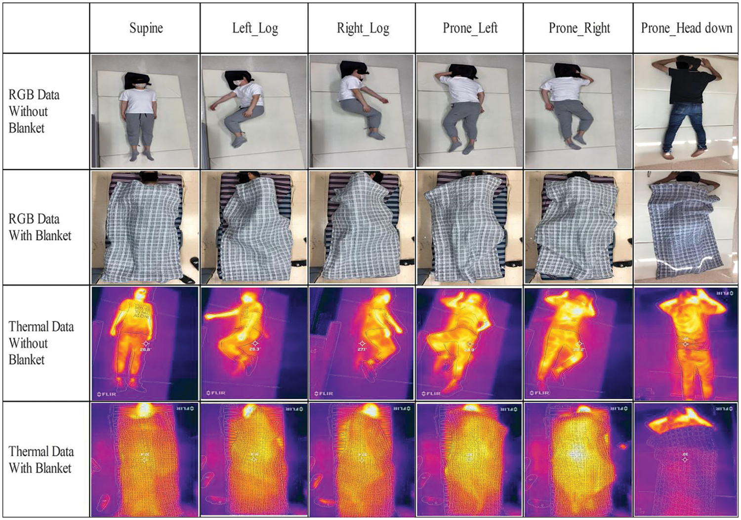 CMES | Free Full-Text | Sleep Posture Classification Using RGB and ...