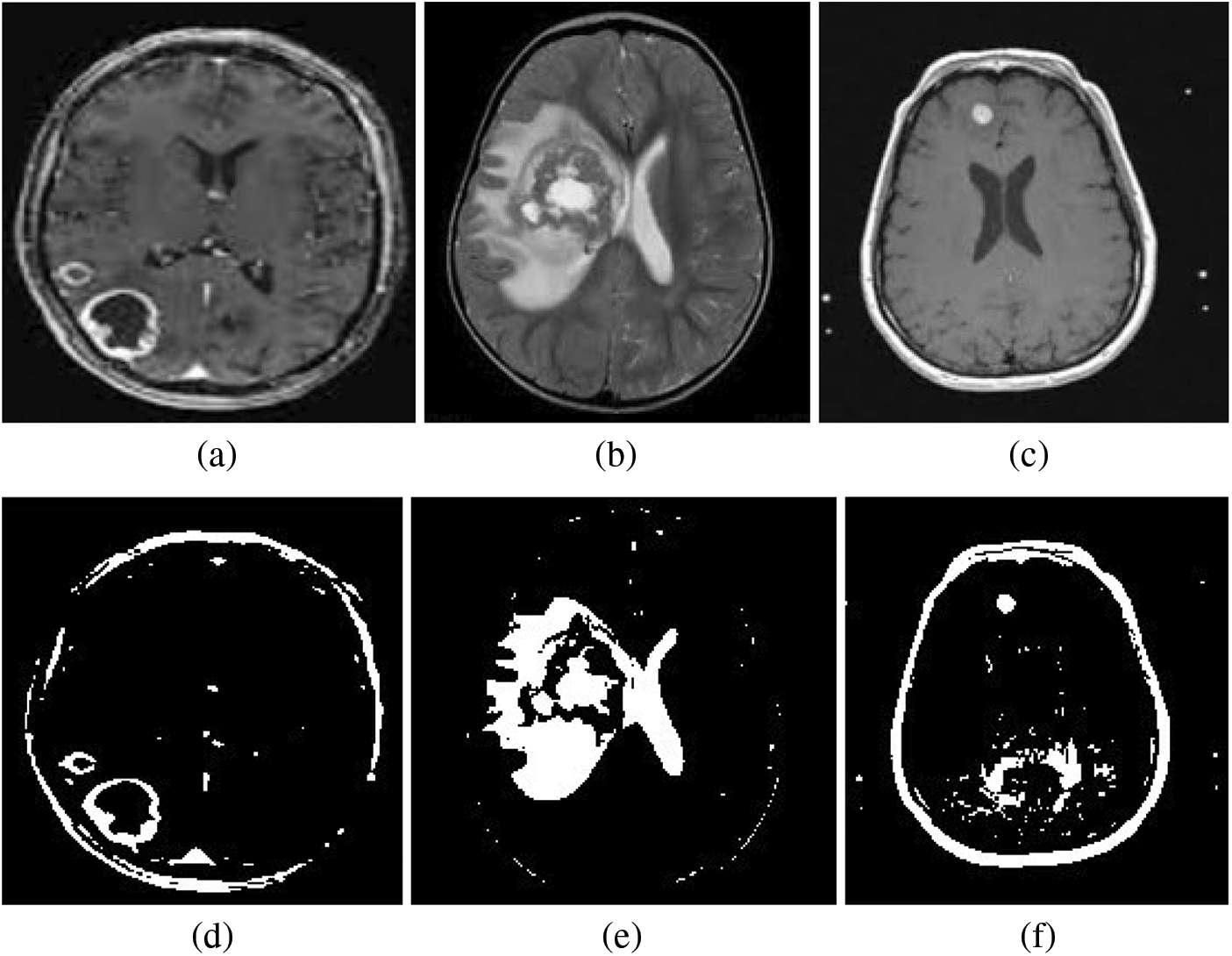 CMES | Free Full-Text | Contrast Normalization Strategies in Brain ...