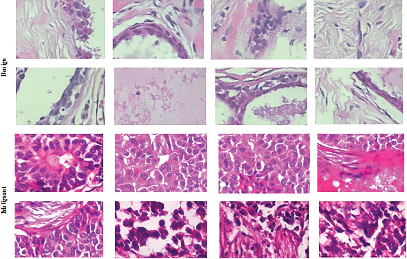 CMES | Free Full-Text | Integrating Transformer and Bidirectional Long ...