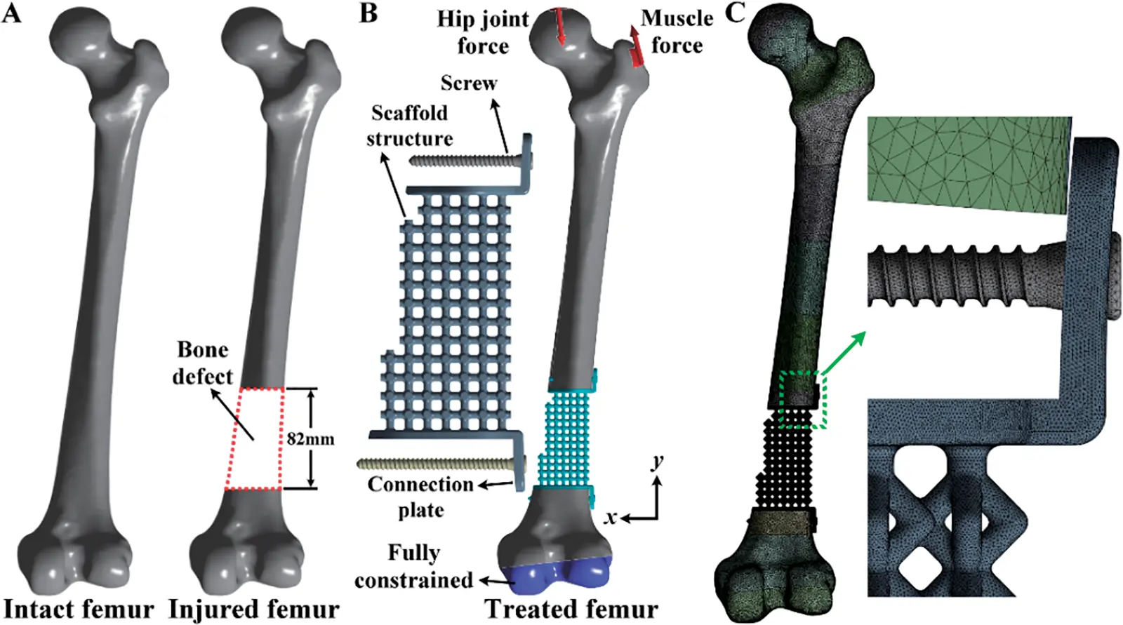 CMES | Free Full-Text | Biomechanical Study of Different Scaffold ...