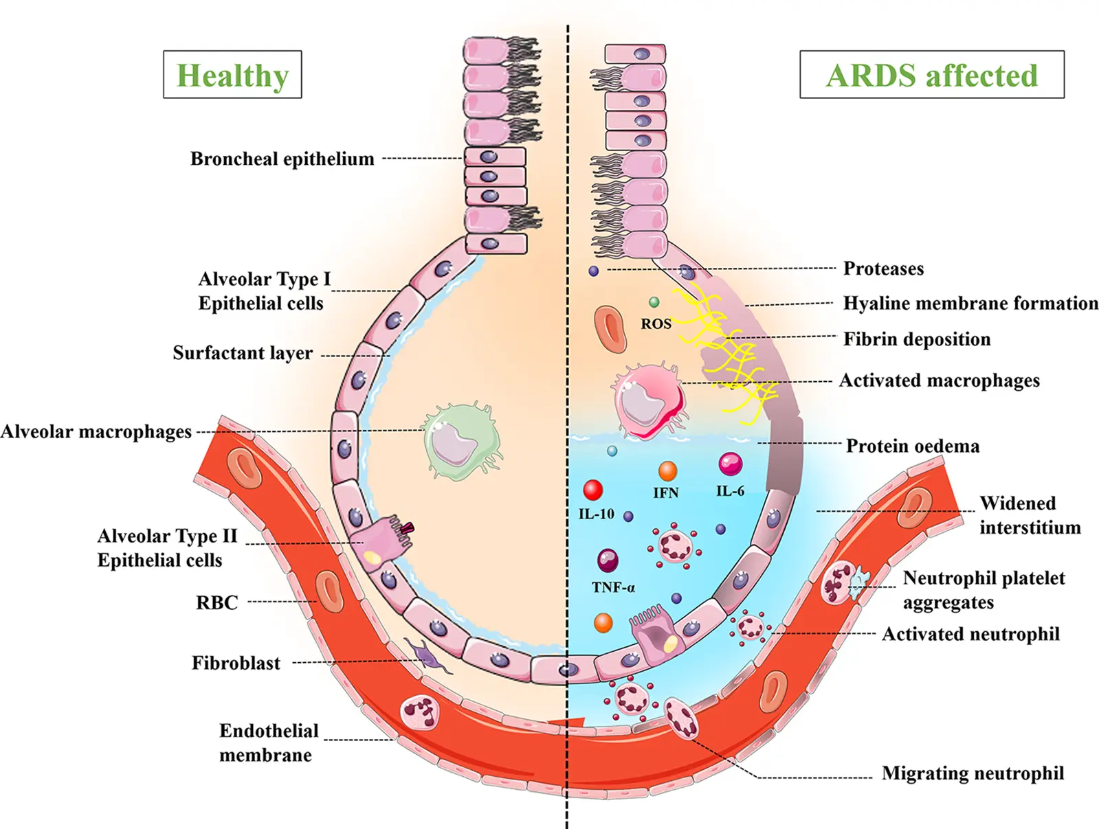 BIOCELL | Free Full-Text | Molecular basis of COVID-19, ARDS and COVID ...