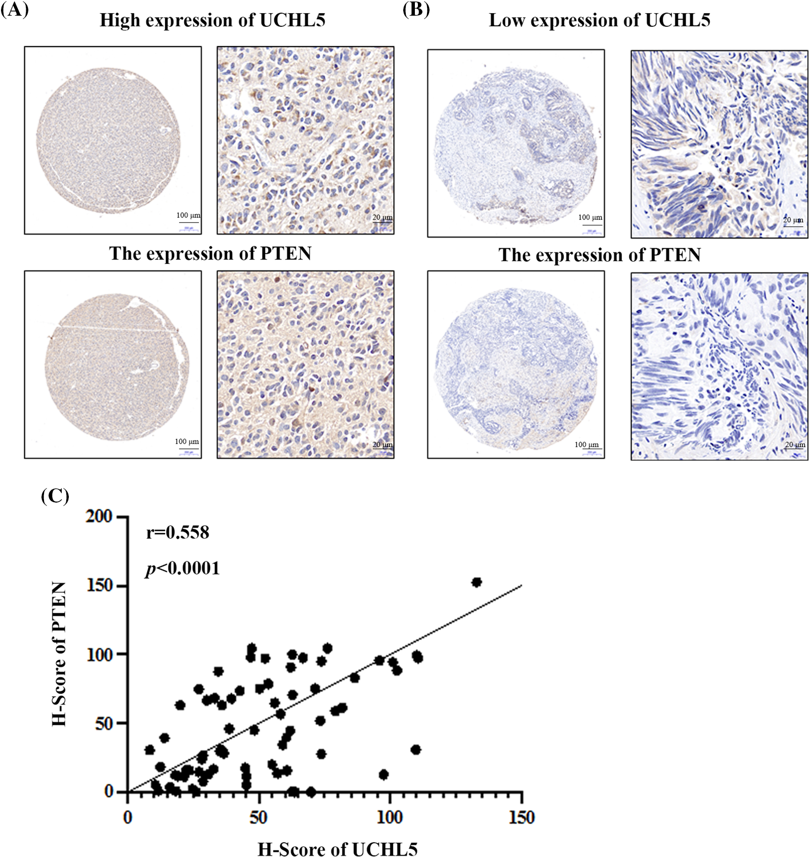 BIOCELL | Free Full-Text | UCHL5 inhibits U251 glioma cell ...