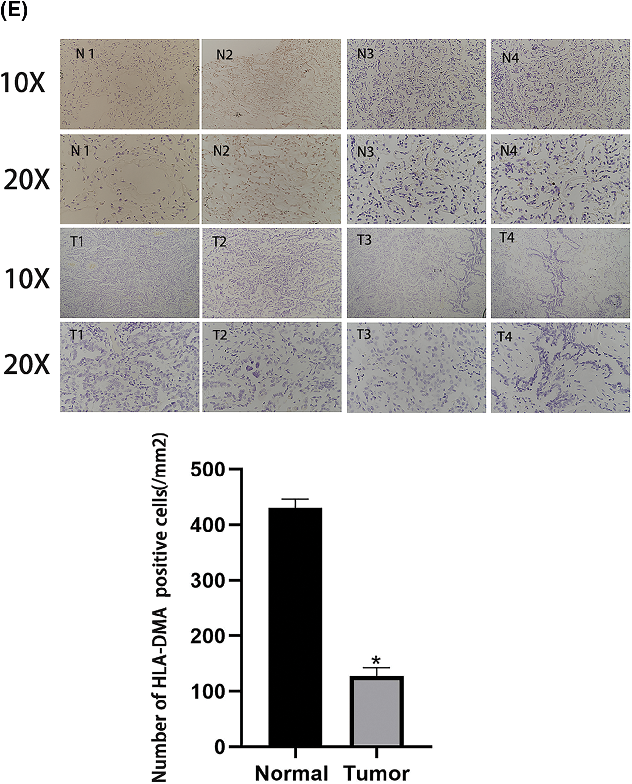 BIOCELL | Free Full-Text | Prognosis and immunological role of HLA-DMA ...