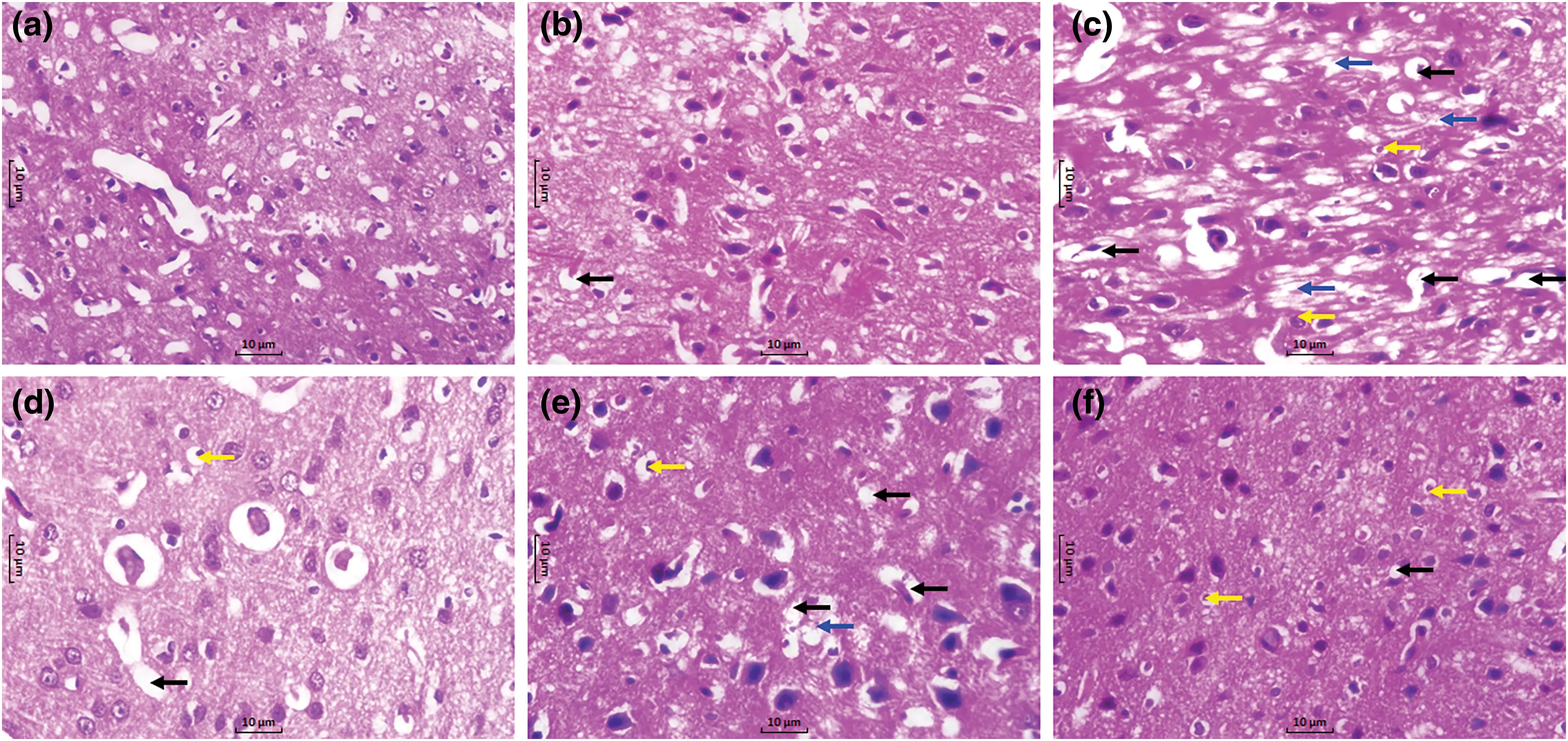 BIOCELL | Free Full-Text | Kaempferol ameliorated levodopa-induced ...