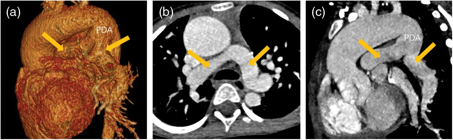CHD | Free Full-Text | Assessment of Intracardiac and Extracardiac ...