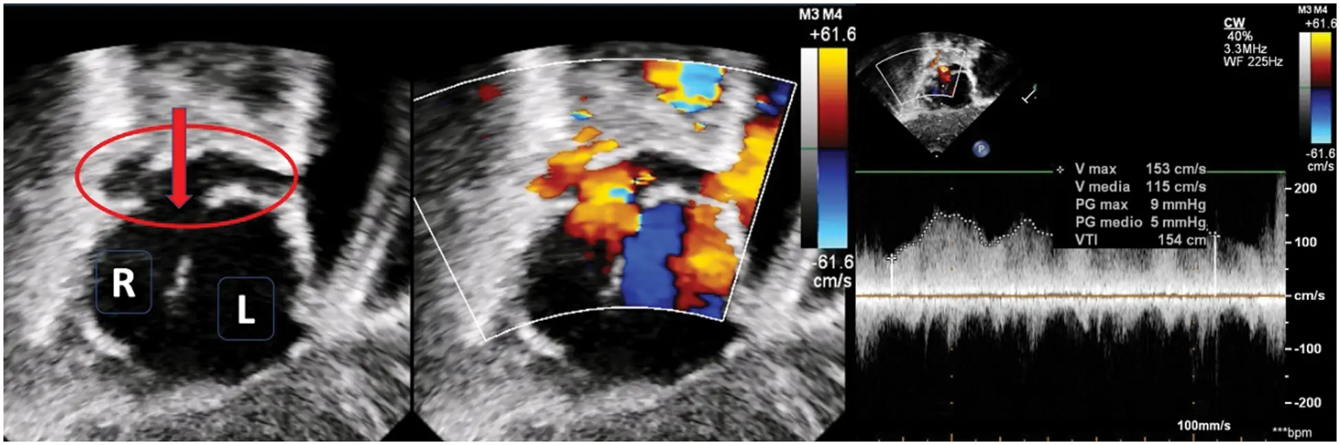 CHD | Free Full-Text | Classifying Cardiac Anomalies in Right and Left ...