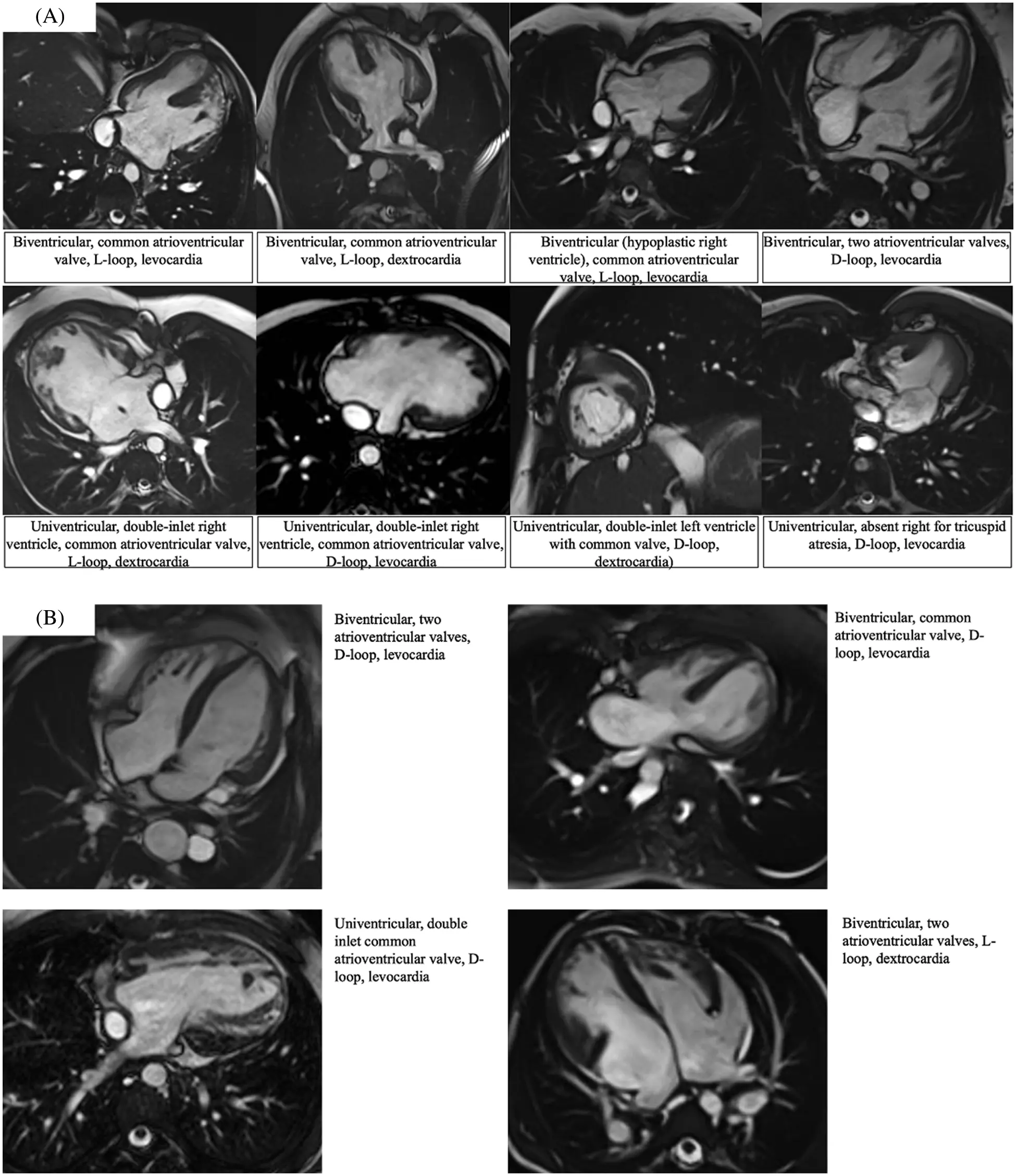 CHD | Free Full-Text | Classifying Cardiac Anomalies in Right and Left ...