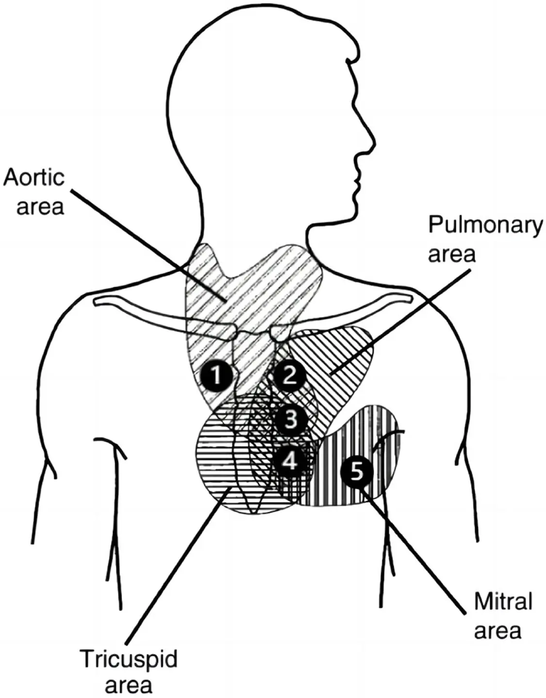 CHD | Free Full-Text | Machine Learning-Based Intelligent Auscultation ...