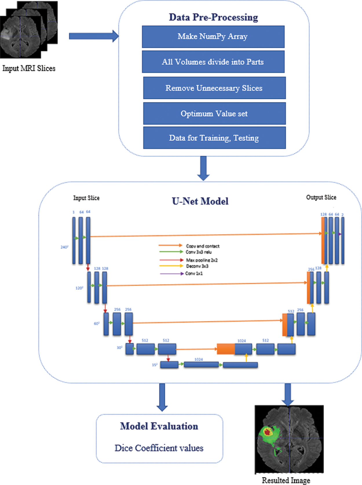 CMC | Free Full-Text | Brain Tumor Segmentation in Multimodal MRI Using ...