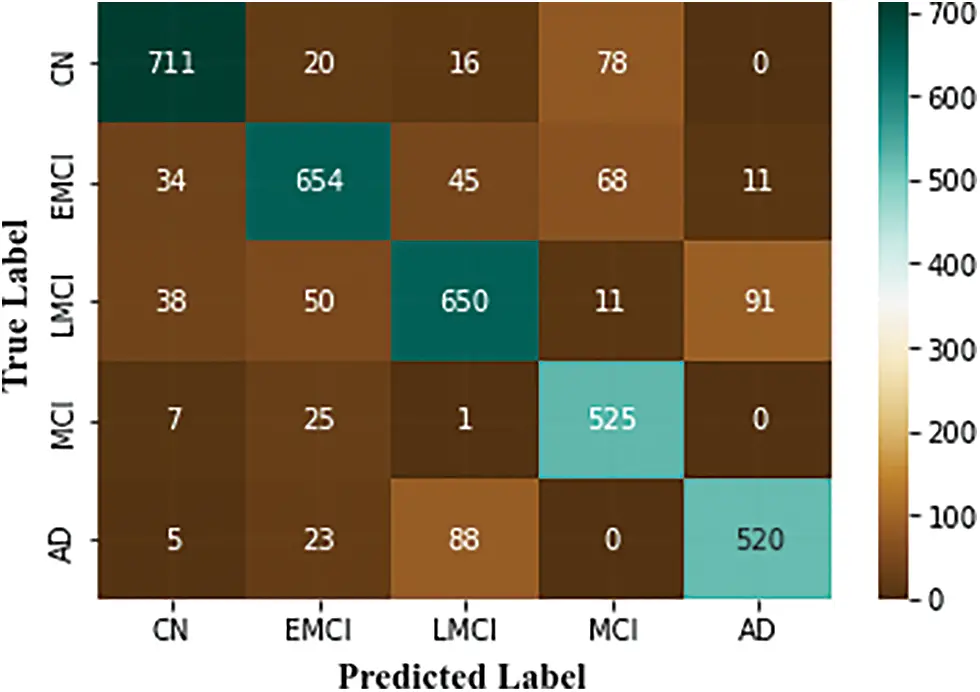 CMC | Free Full-Text | Xception-Fractalnet: Hybrid Deep Learning Based Multi-Class ...