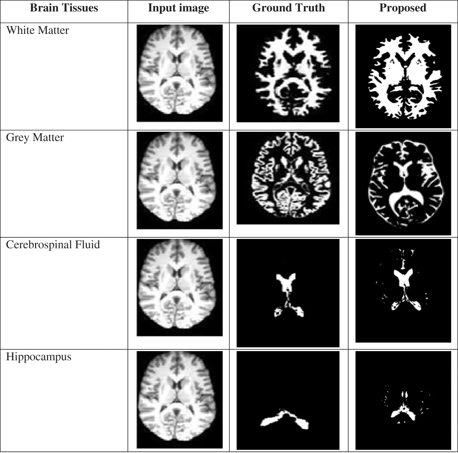 CMC | Free Full-Text | Xception-Fractalnet: Hybrid Deep Learning Based Multi-Class ...
