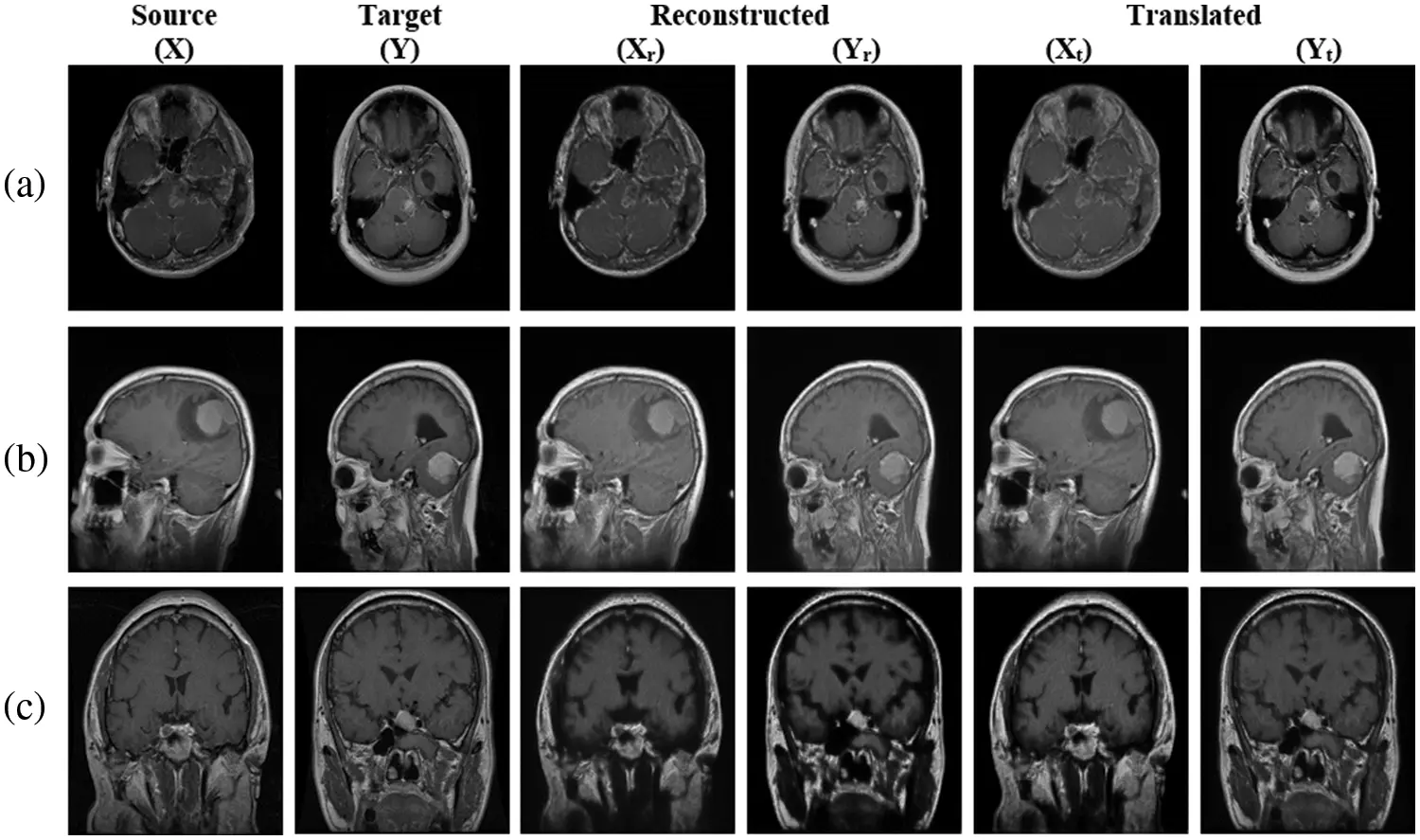 CMC | Free Full-Text | Improving Brain Tumor Classification with Deep ...