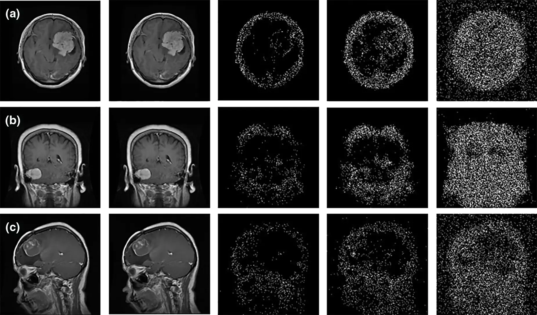 CMC | Free Full-Text | MI-STEG: A Medical Image Steganalysis Framework ...