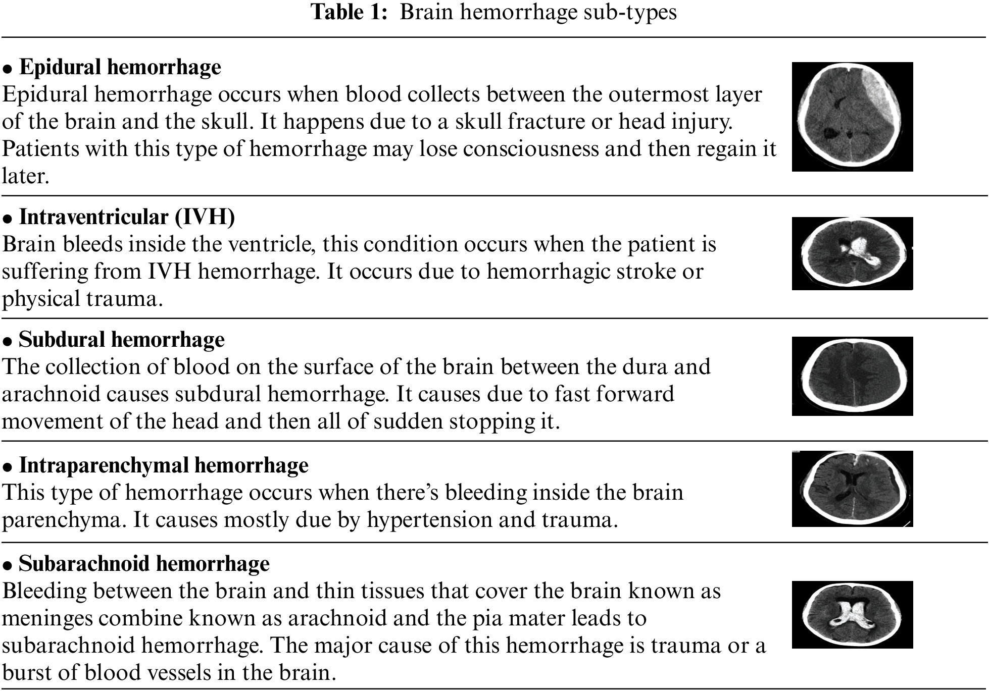 CMC | Free Full-Text | Automated Brain Hemorrhage Classification and Volume Analysis