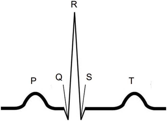 CMC | Free Full-Text | TinyML-Based Classification in an ECG Monitoring Embedded System