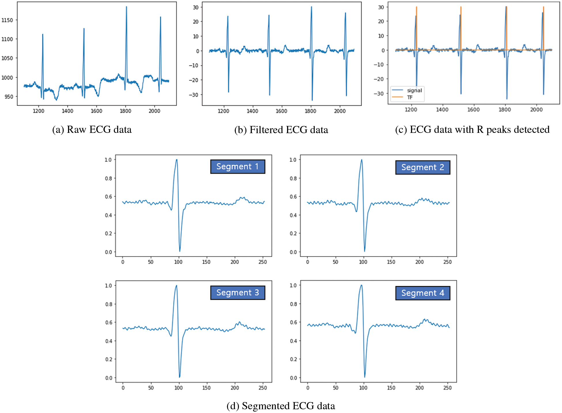 CMC | Free Full-Text | TinyML-Based Classification in an ECG Monitoring Embedded System