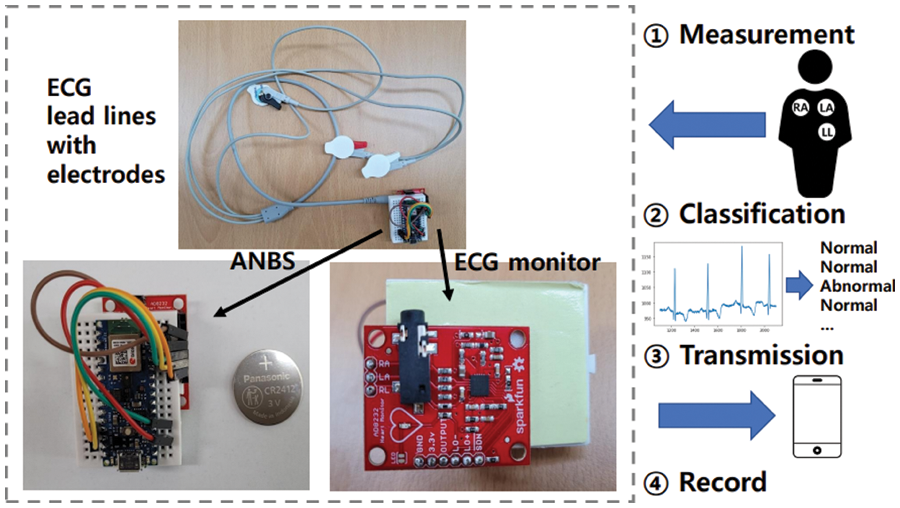 CMC | Free Full-Text | TinyML-Based Classification in an ECG Monitoring Embedded System