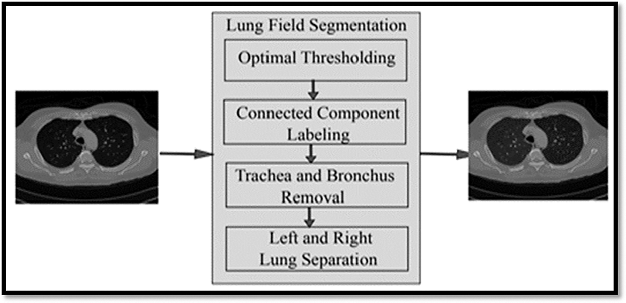 CMC | Free Full-Text | Lung Cancer Segmentation with Three-Parameter ...