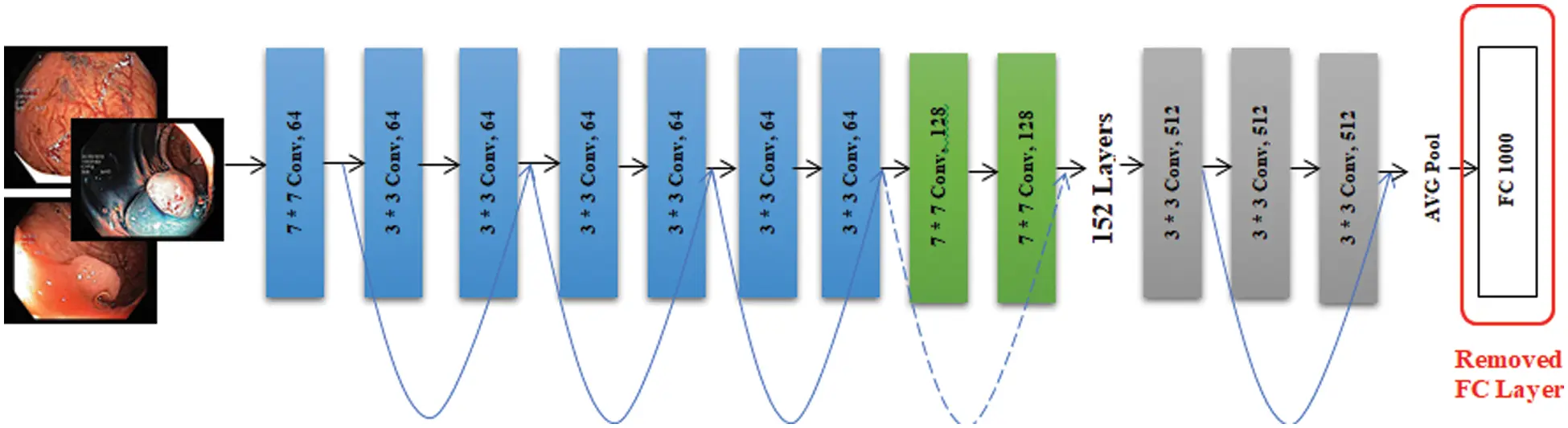 CMC | Free Full-Text | Gastrointestinal Diseases Classification Using ...