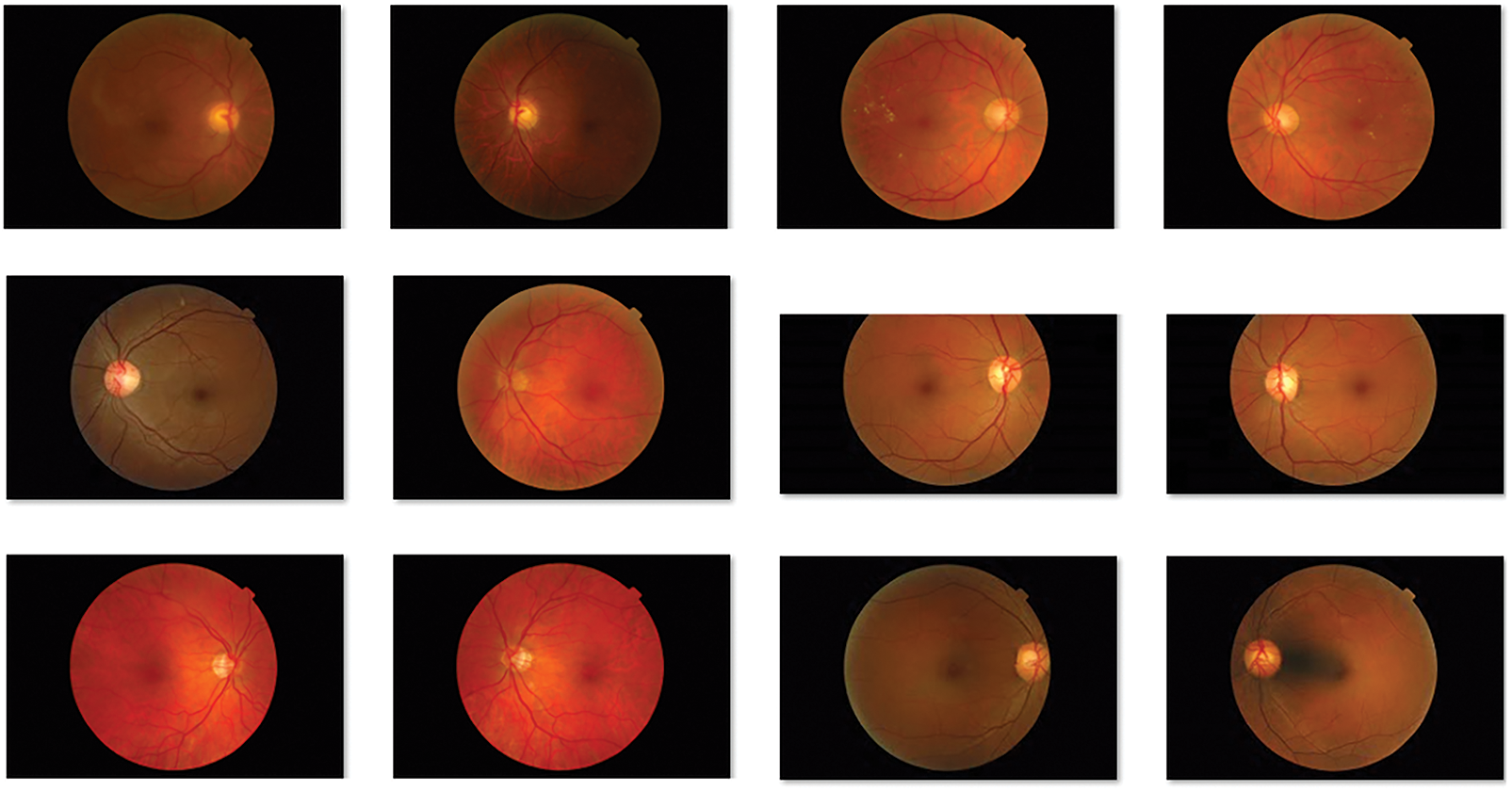 CMC | Free Full-Text | Blood Vessel Segmentation with Classification ...
