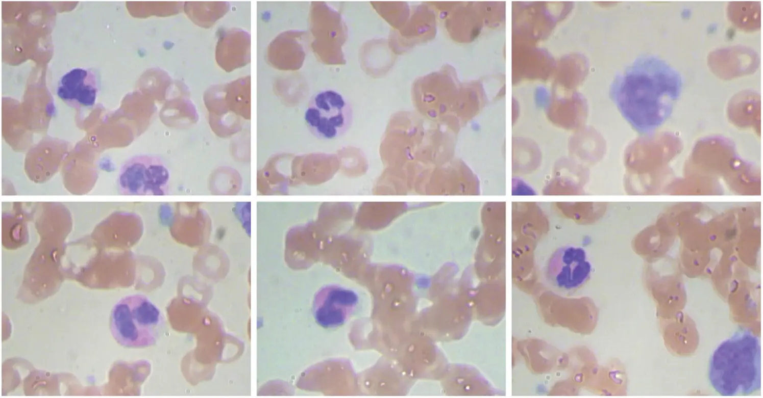 CMC | Free Full-Text | Automated Artificial Intelligence Empowered ...