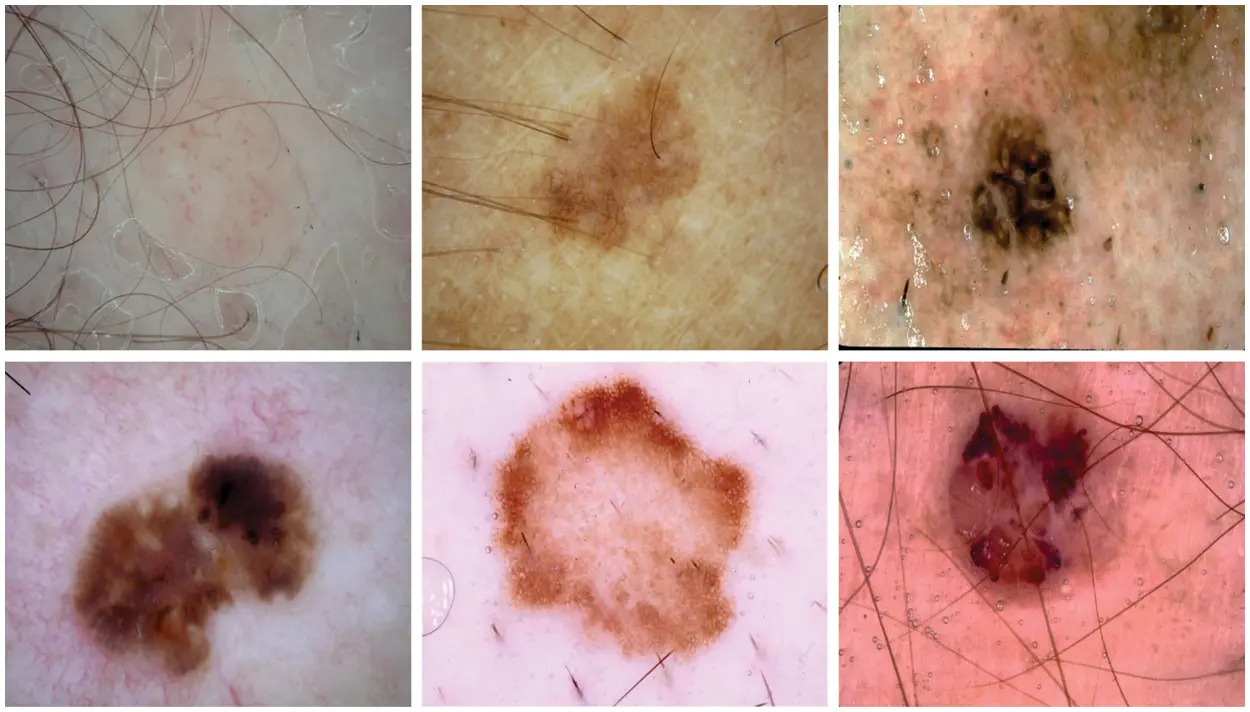 CMC | Free Full-Text | Arithmetic Optimization with Ensemble Deep ...