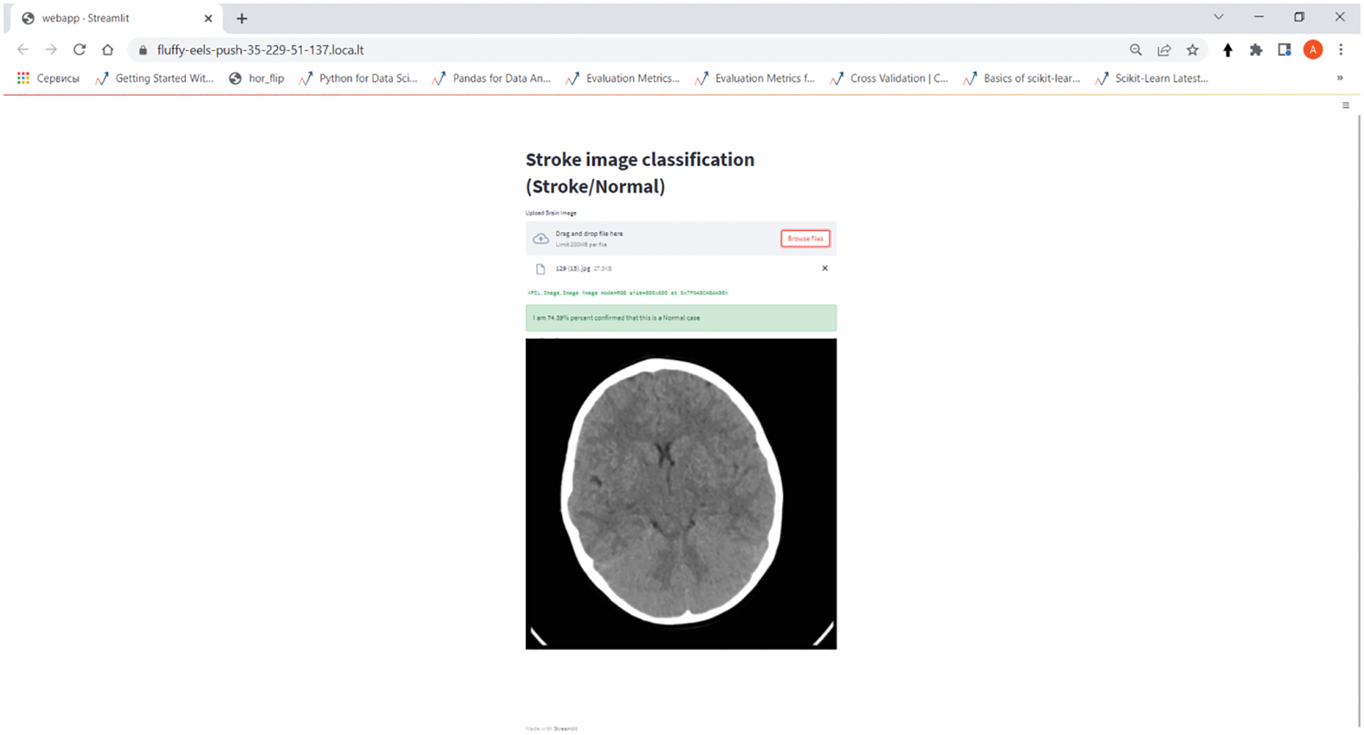 CMC | Free Full-Text | Deep Learning-Enabled Brain Stroke ...