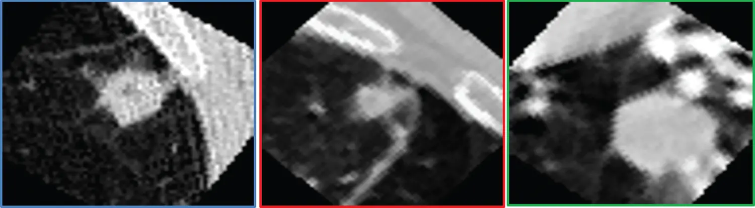 CMC | Free Full-Text | End-to-End 2D Convolutional Neural Network Architecture for Lung Nodule ...