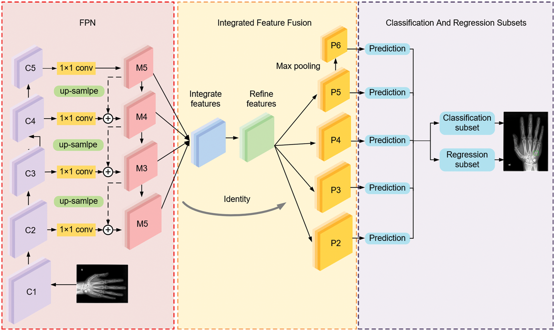 CMC | Free Full-Text | MPFracNet: A Deep Learning Algorithm for Metacarpophalangeal Fracture ...