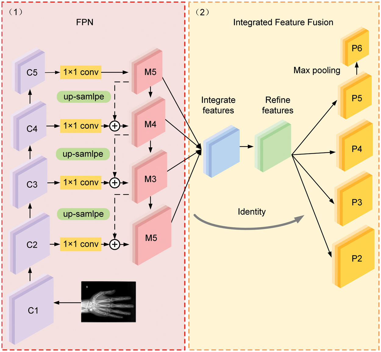 CMC | Free Full-Text | MPFracNet: A Deep Learning Algorithm for ...