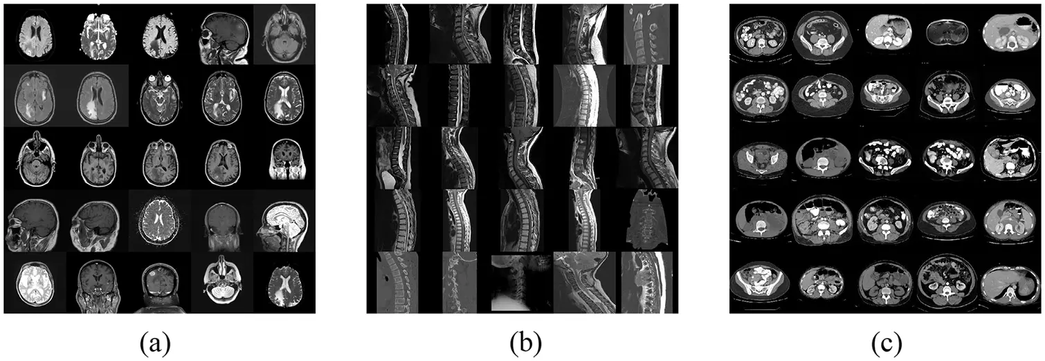 CMC | Free Full-Text | Robust Multi-Watermarking Algorithm for Medical ...