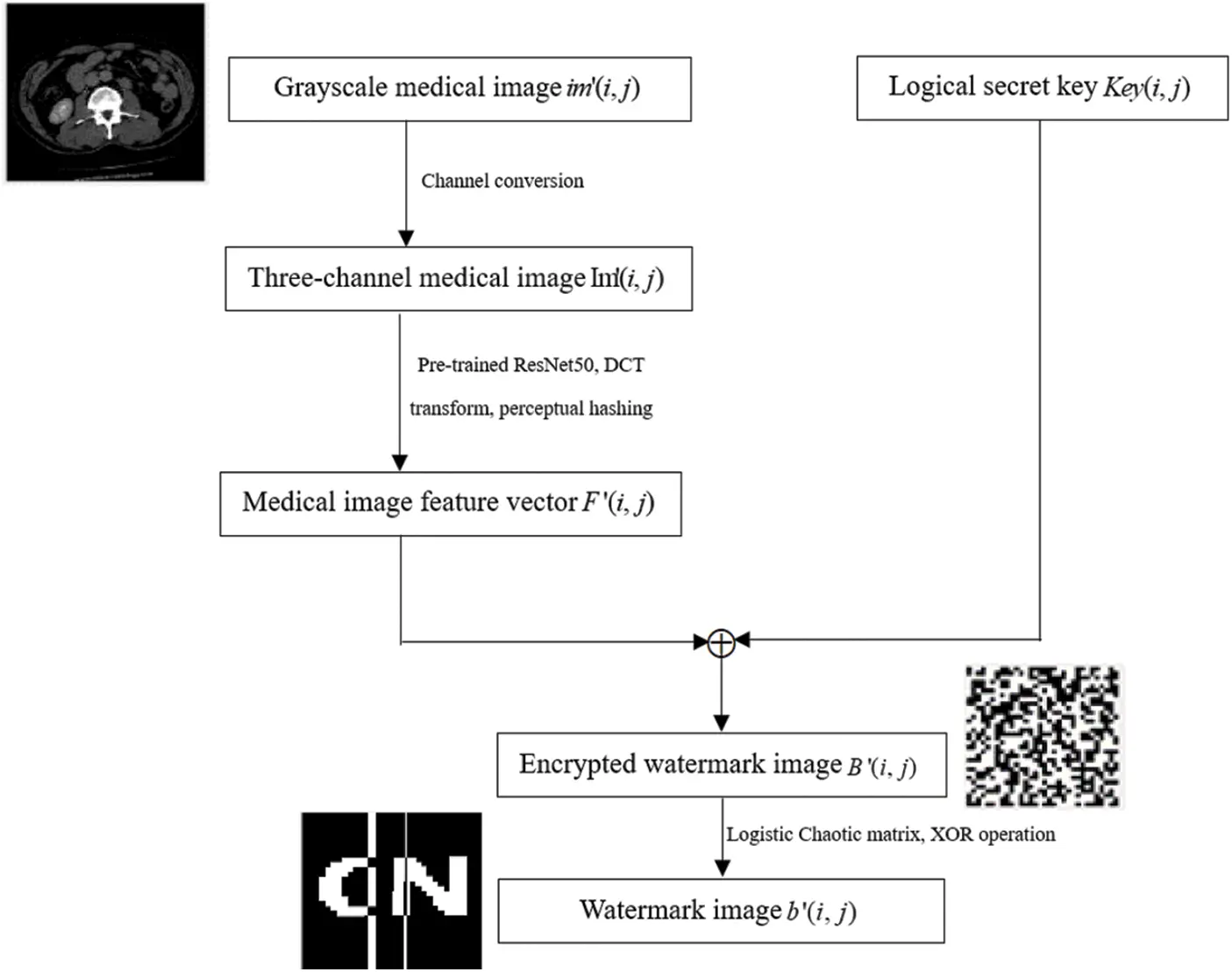 CMC | Free Full-Text | Zero Watermarking Algorithm for Medical Image ...