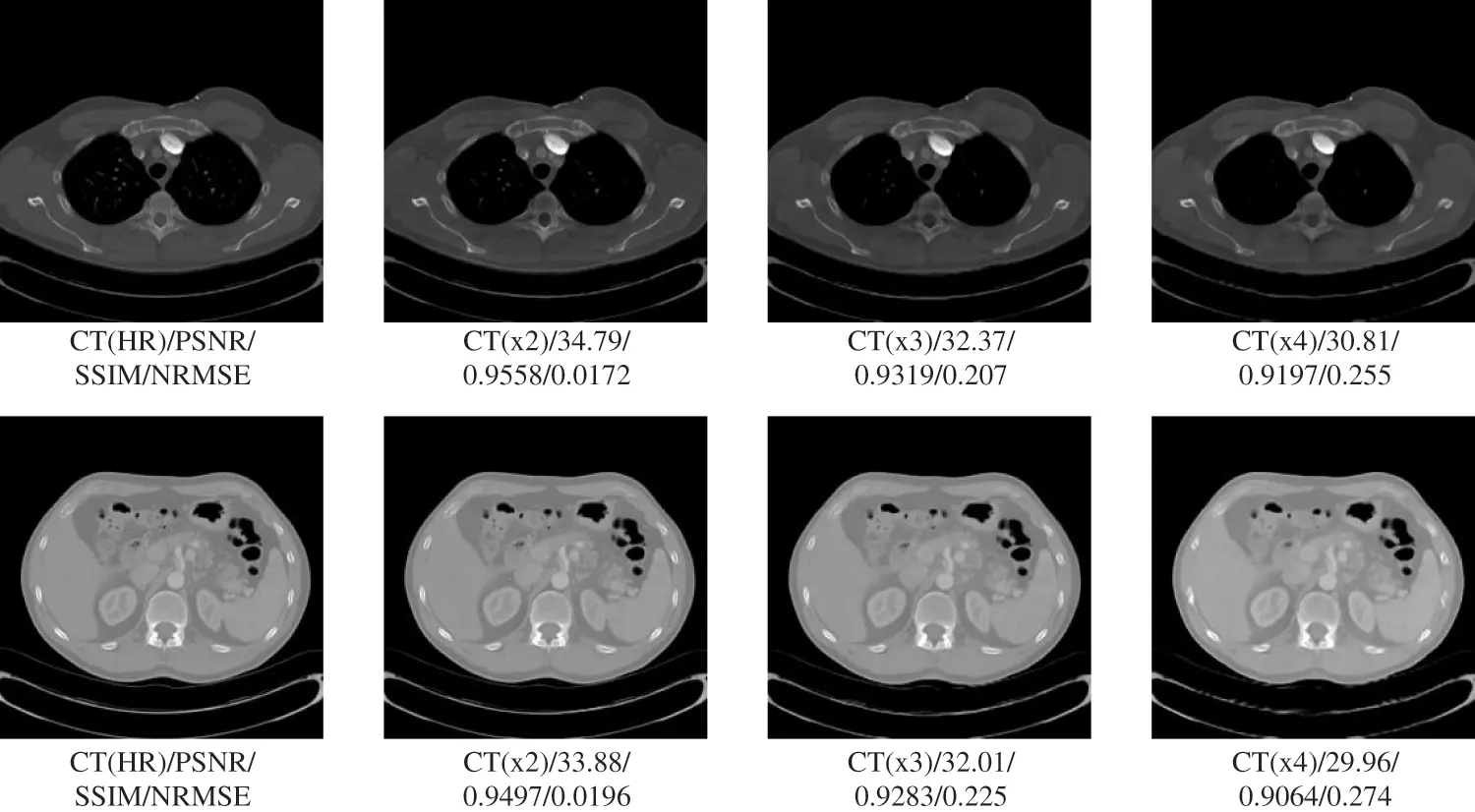 CMC | Free Full-Text | Meta-Learning Multi-Scale Radiology Medical ...