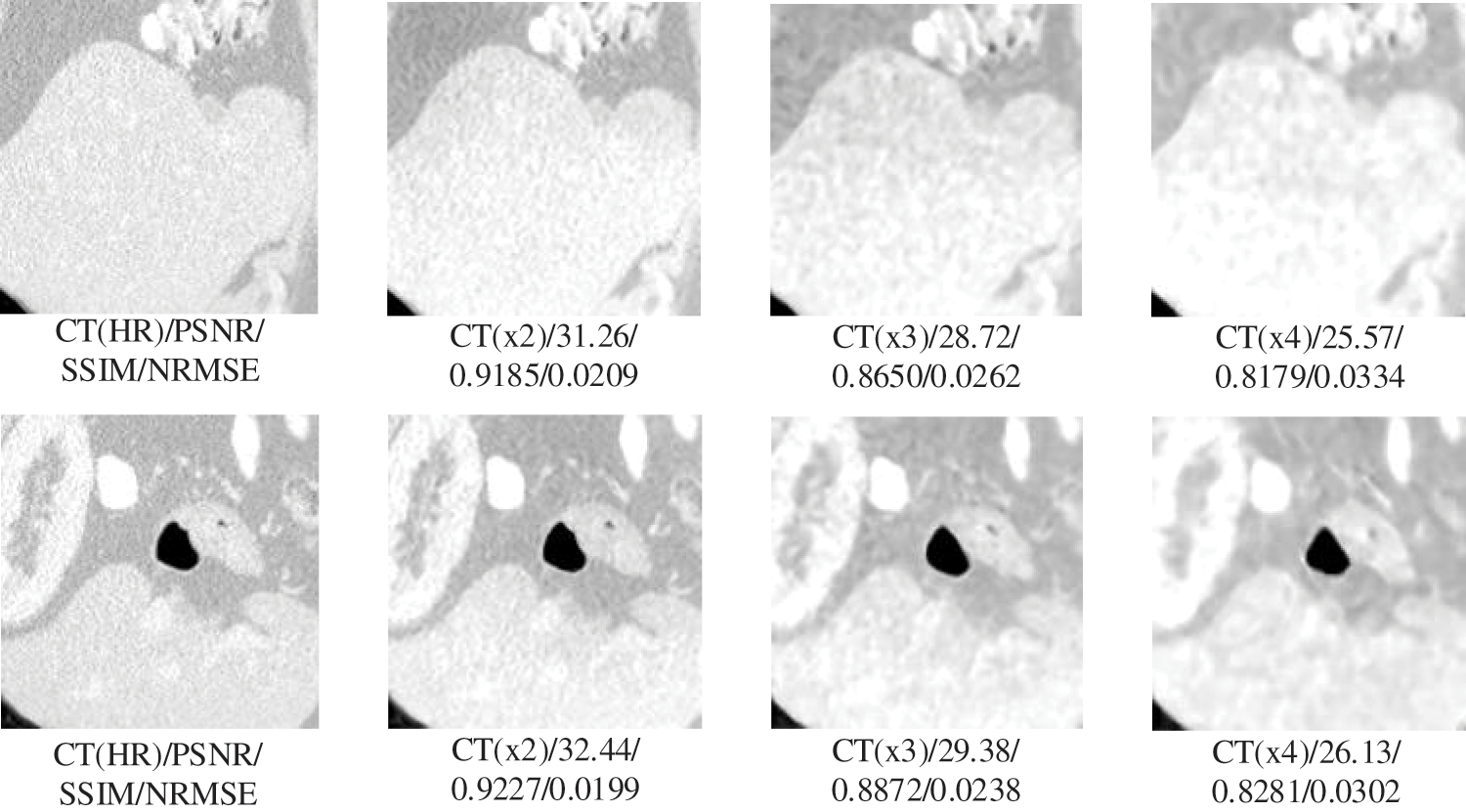 CMC | Free Full-Text | Meta-Learning Multi-Scale Radiology Medical ...