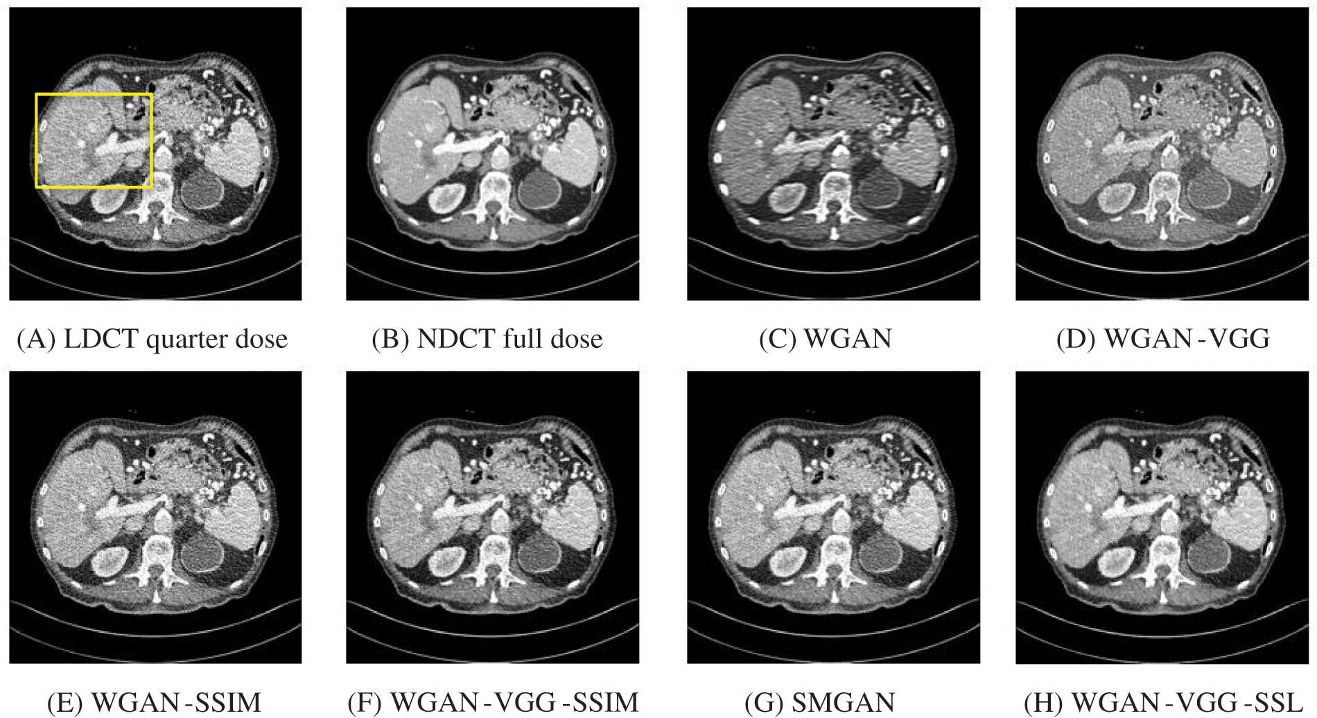 CMC | Free Full-Text | Variant Wasserstein Generative Adversarial ...